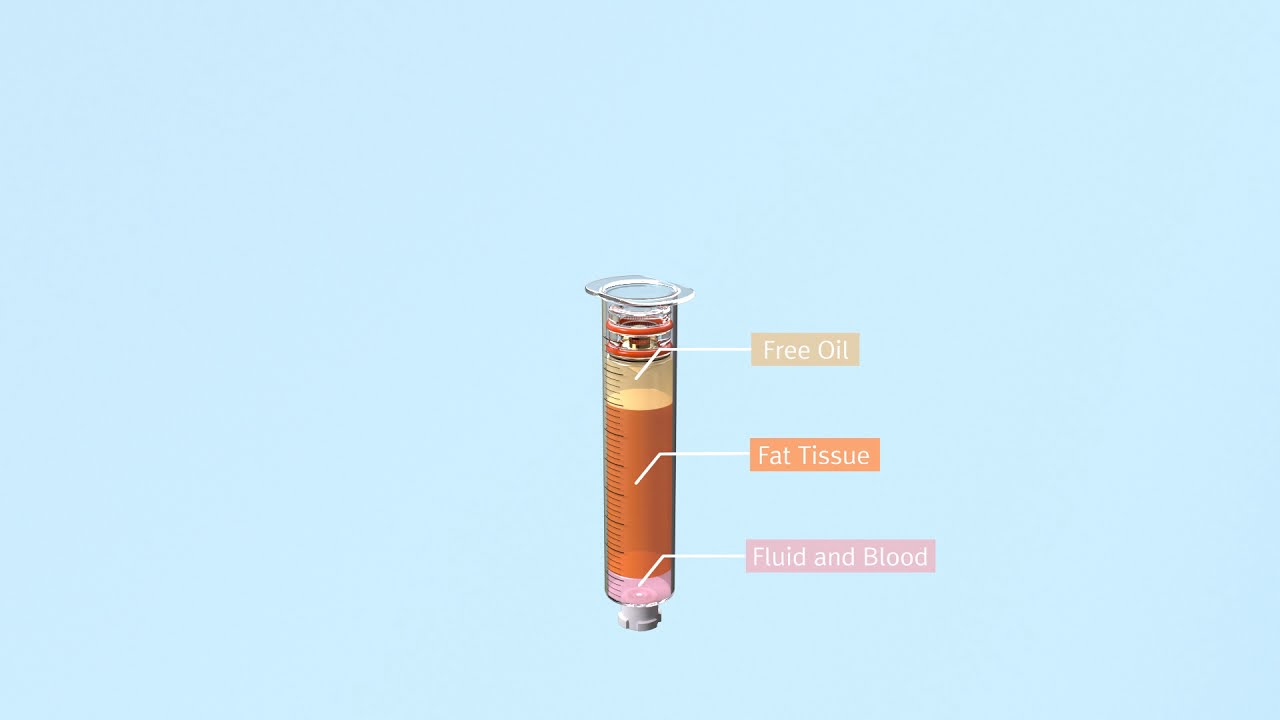 Adinizer Introduction for ARAT - YouTube