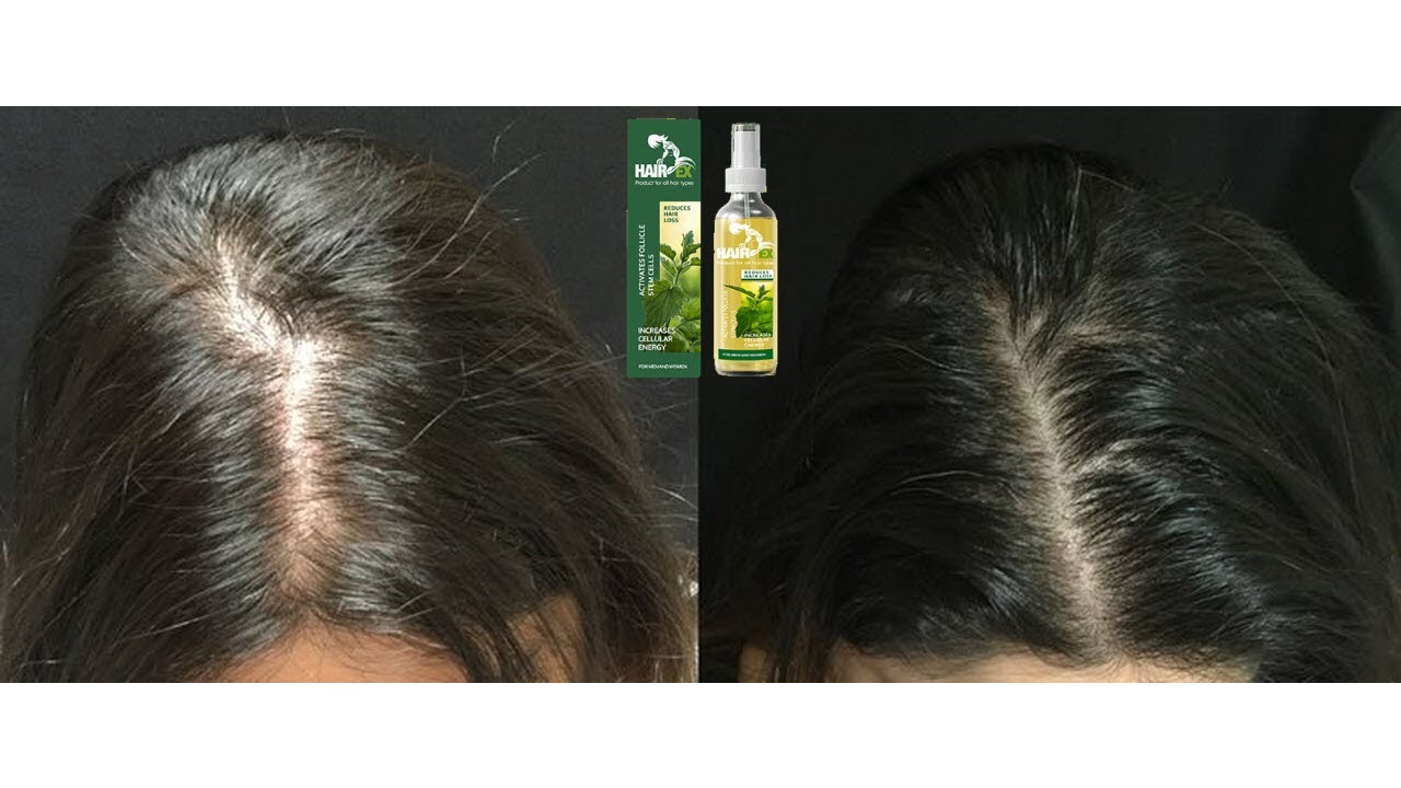 Hairex Para Que Sirve - YouTube