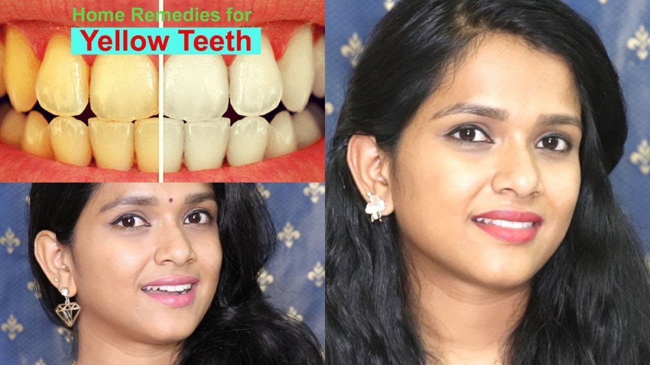 Teeth Whitening At Home In 2 Minutes || How To Whiten Your Yellow Teeth ...
