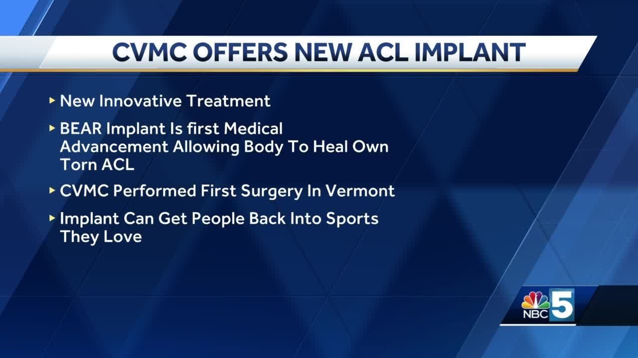 CVMC in Berlin first hospital in Vermont to offer new ACL implant - YouTube