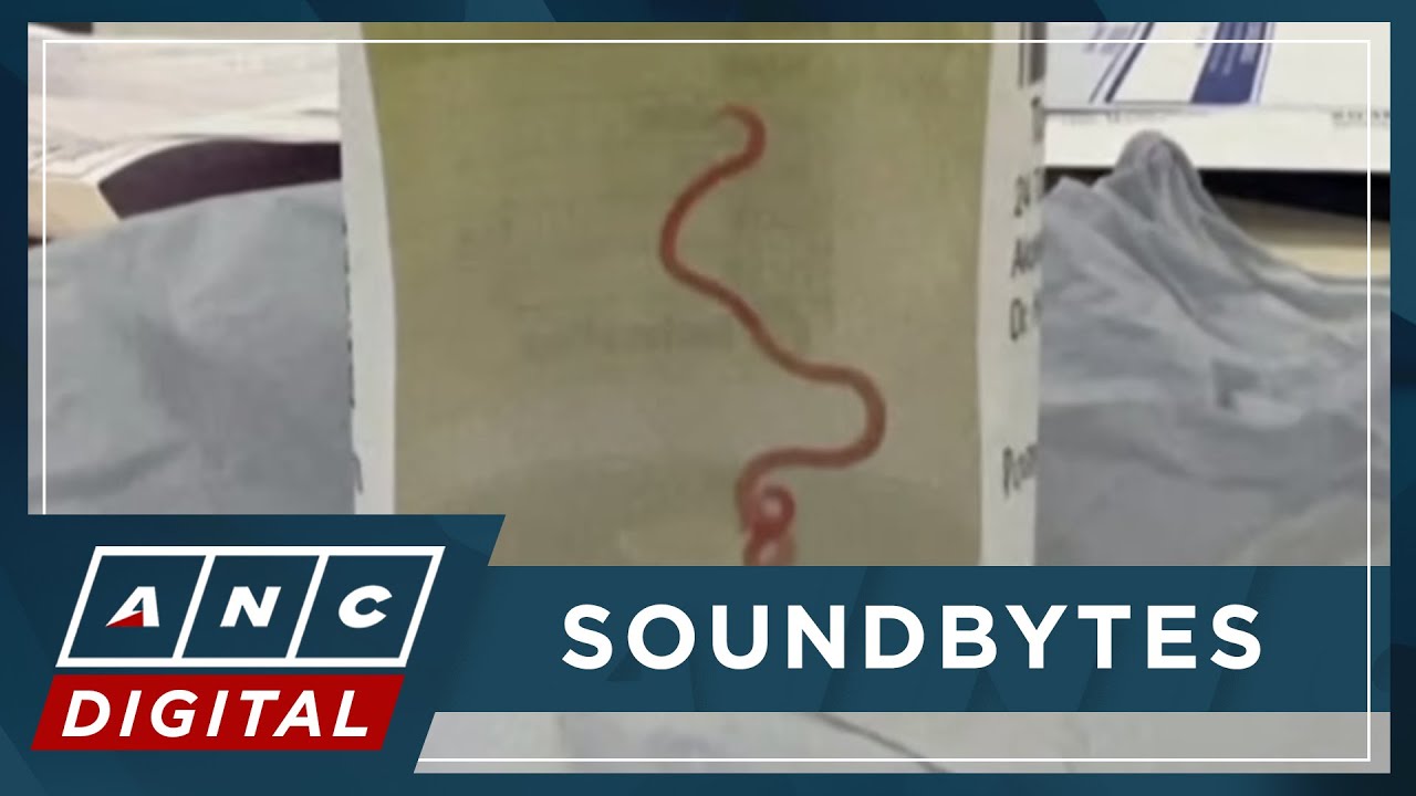 'A big shock': Live worm found in Australian woman's brain in world ...