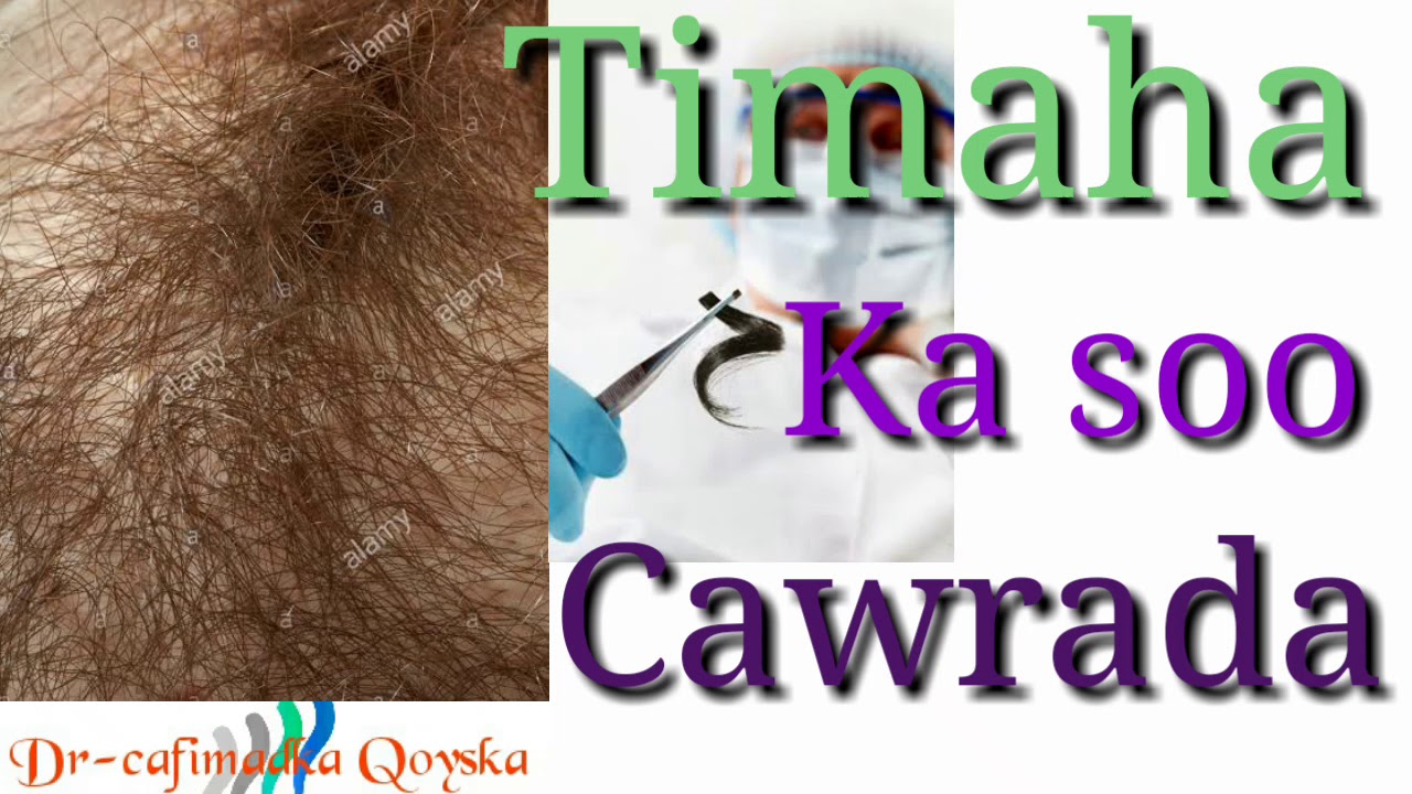 Daawo. Timaha Ka Soo Baxa Xubnaha Taranka Dushooda - YouTube