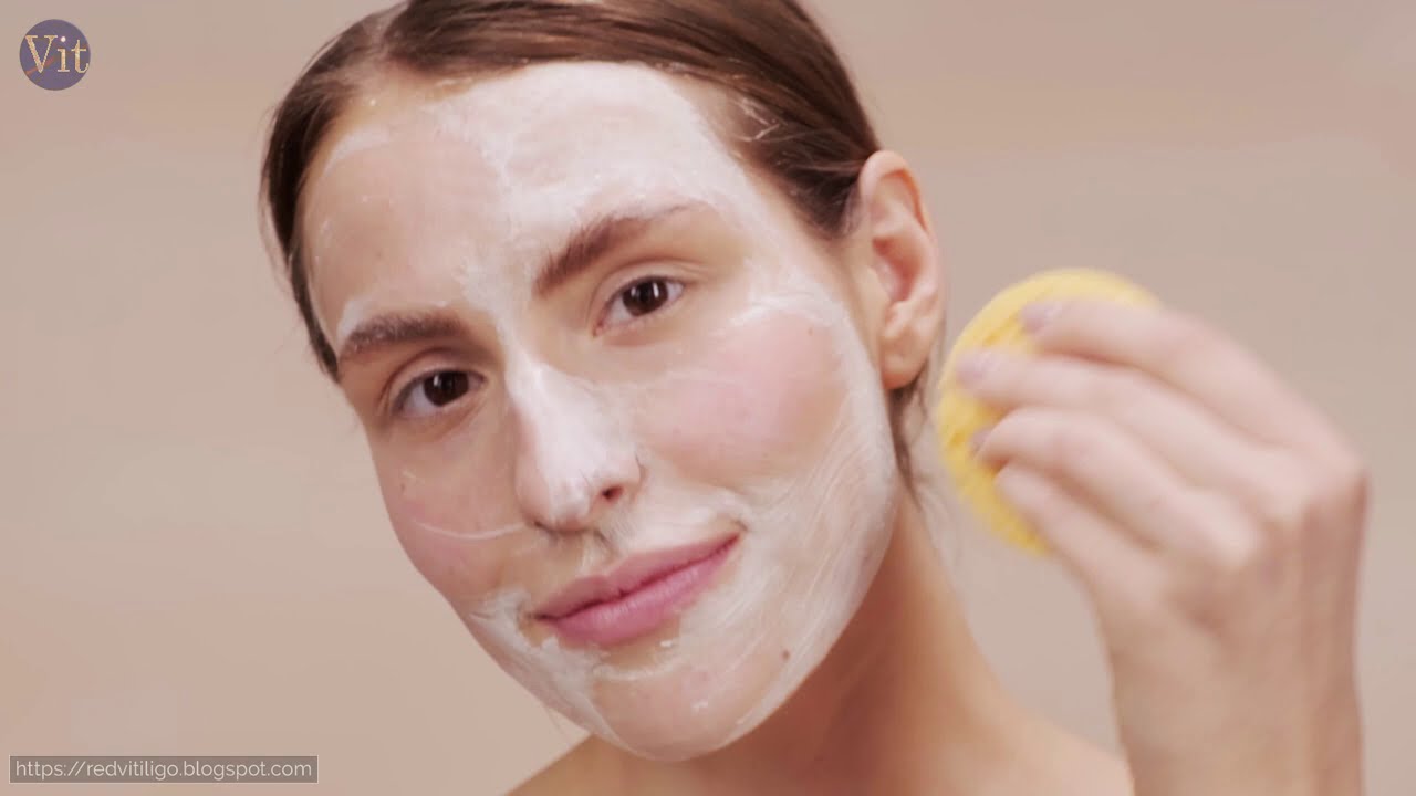 AVITIL GEL, Cómo Curar El Vitiligo. - YouTube