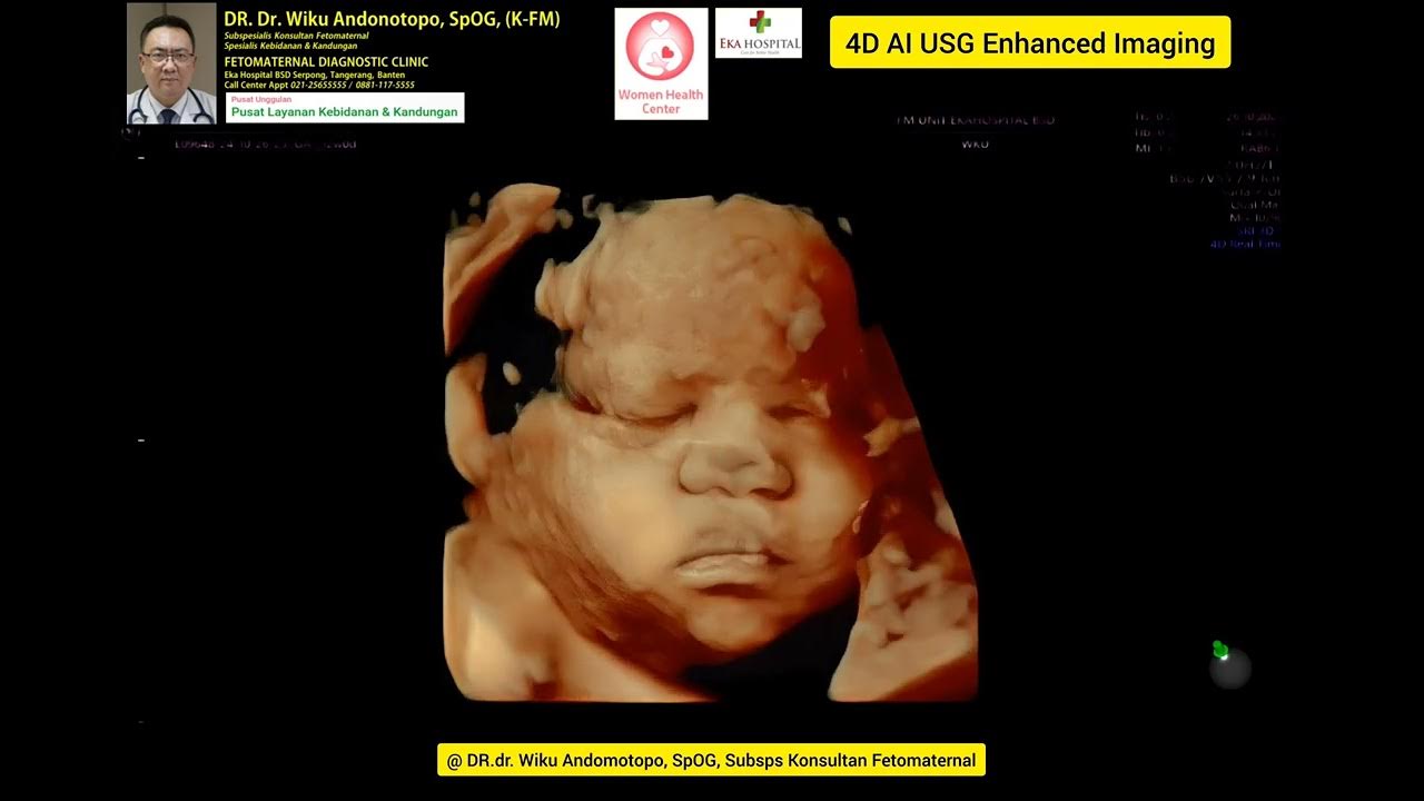 4D AI Enhanced Imaging - YouTube