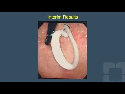#201 UroMonitor Catheter-Free Wireless Ambulatory Cystometry is ...