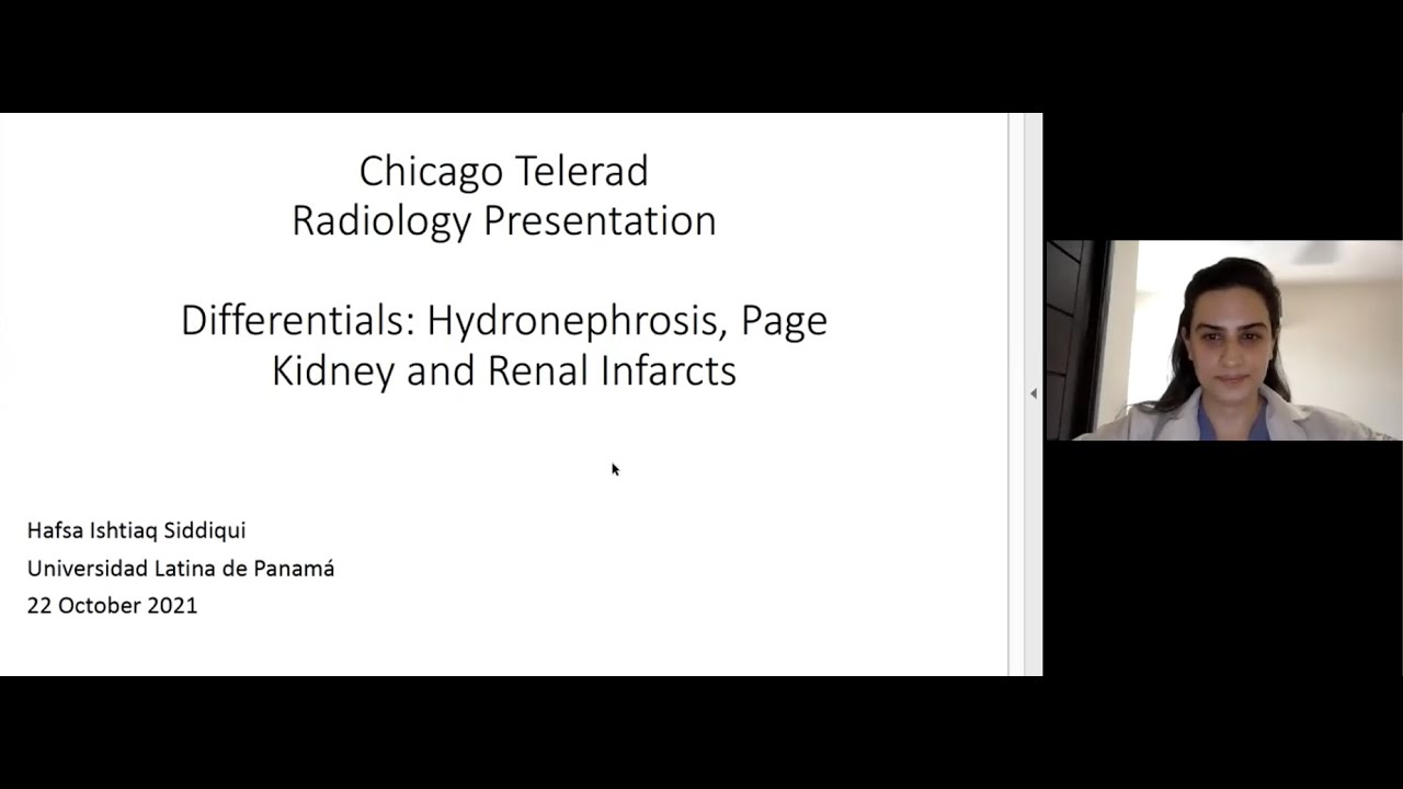 Chicago Telerad Extern Hafsa Ishtiaq Presents on Hydronephrosis, Page ...