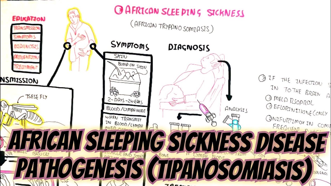 African Sleeping Sickness disease(trypanosomiasis)sign and symptom ...