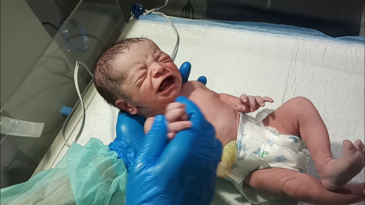 Initial Assessment of a Newborn Baby | Amazing First Moments! - YouTube