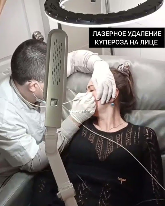 Лазерное удаление купероза Youtube