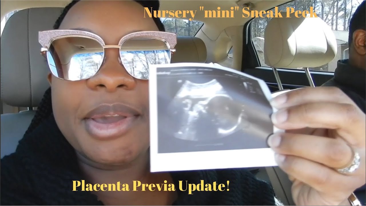 28-Week Pregnancy Check-up || Third Trimester || Pregnancy After ...