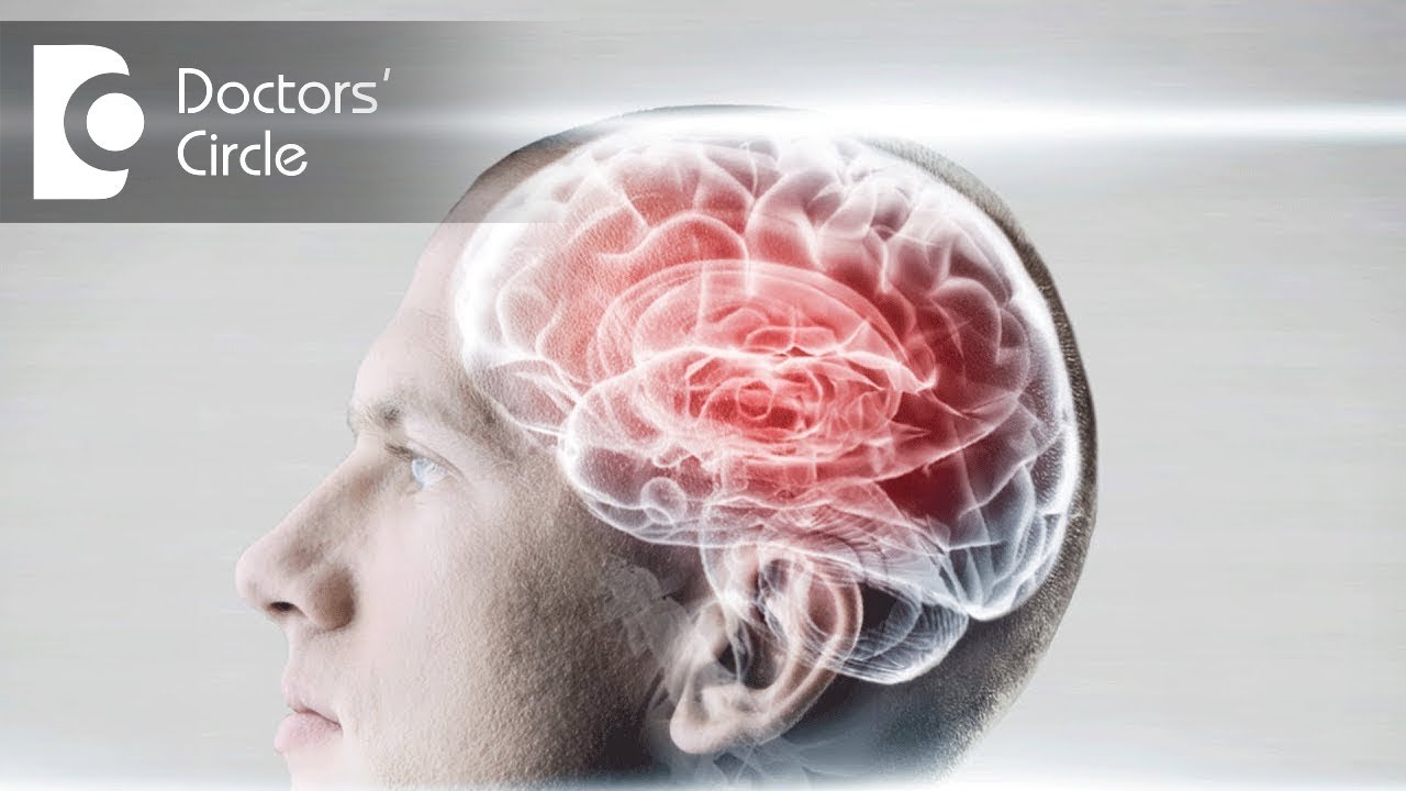 Symptoms & risk of bleeding caused by Arteriovenous Malformation AVM ...