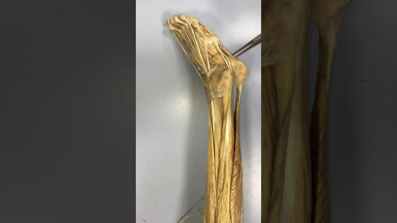 Anatomy of the LL pt.6 - Explanation on a plastinated model. - YouTube