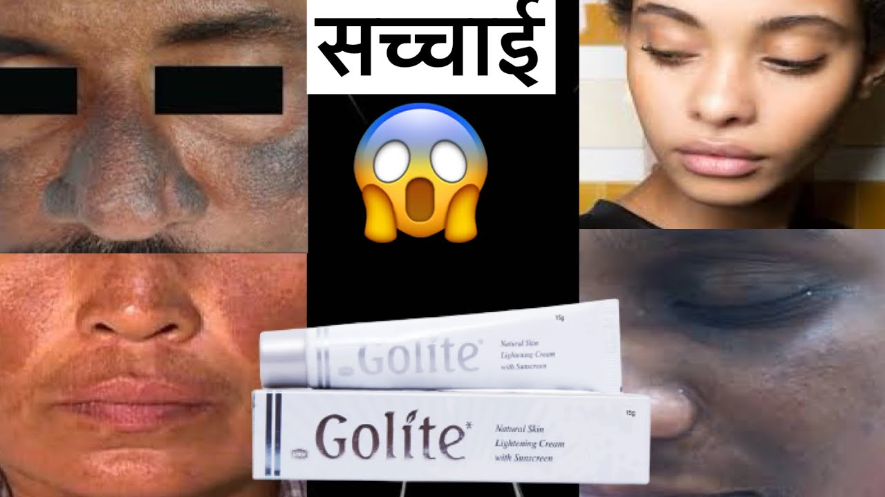 Golite cream | golite cream review | Golite natural skin lightening ...
