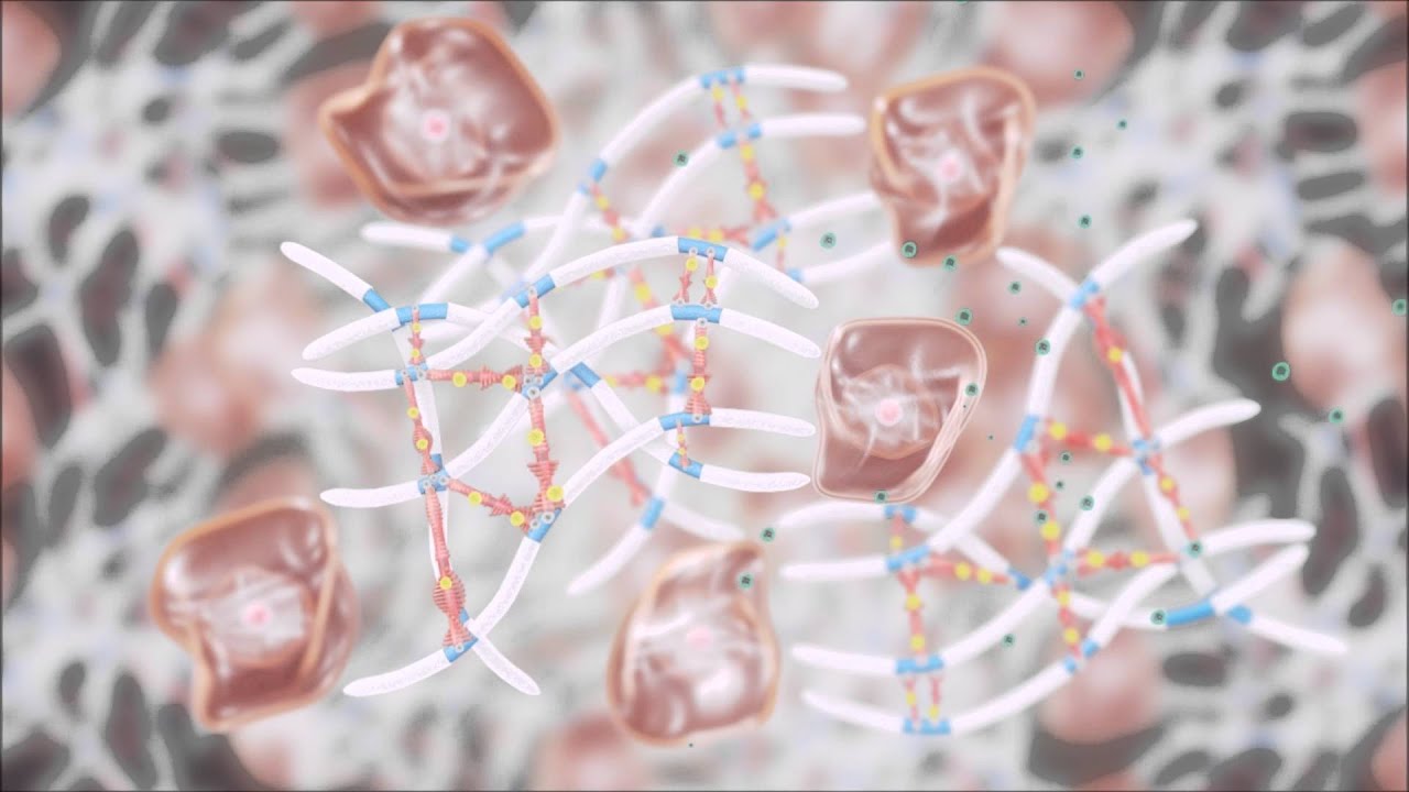 CACIPLIQ20 - ANIMATION - ECM part 1 - YouTube