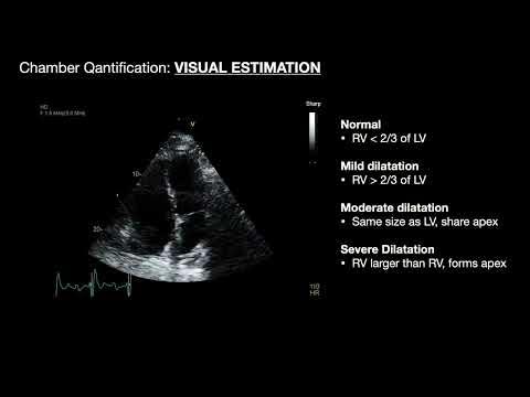 Right ventricle: Anatomy and Chamber Quantification - YouTube