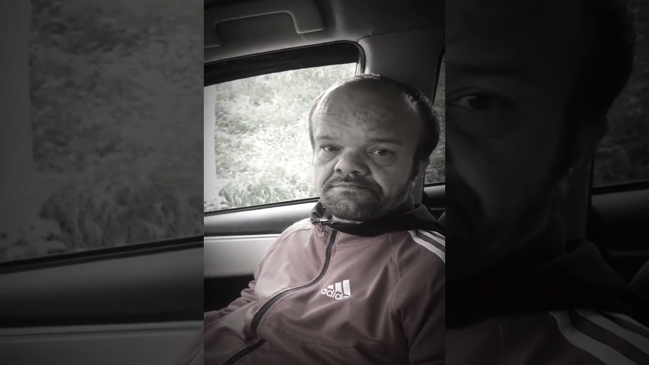 TURKISH DWARF Yasin ERCIRE - YouTube