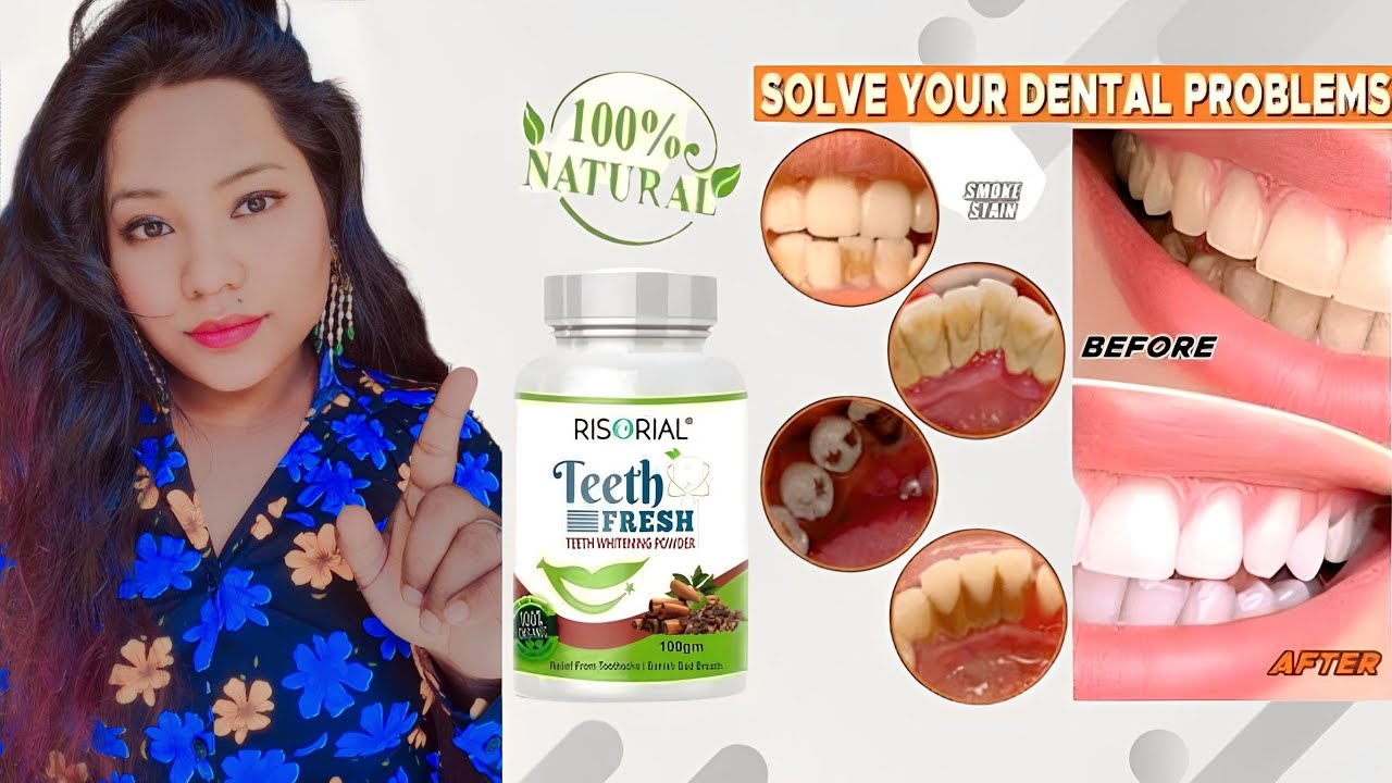 RISORIAL Activated Charcoal Teeth Powder For Teeth Whitening Powder ...