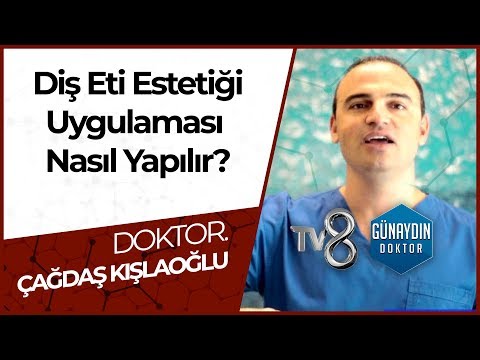 Pembe Estetik (Diş Eti Estetiği) Nedir? - DR. Çağdaş KIŞLAOĞLU