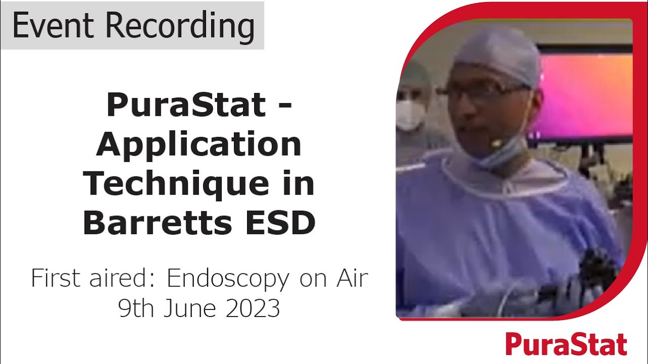 PuraStat - Application Technique in Barretts ESD - YouTube