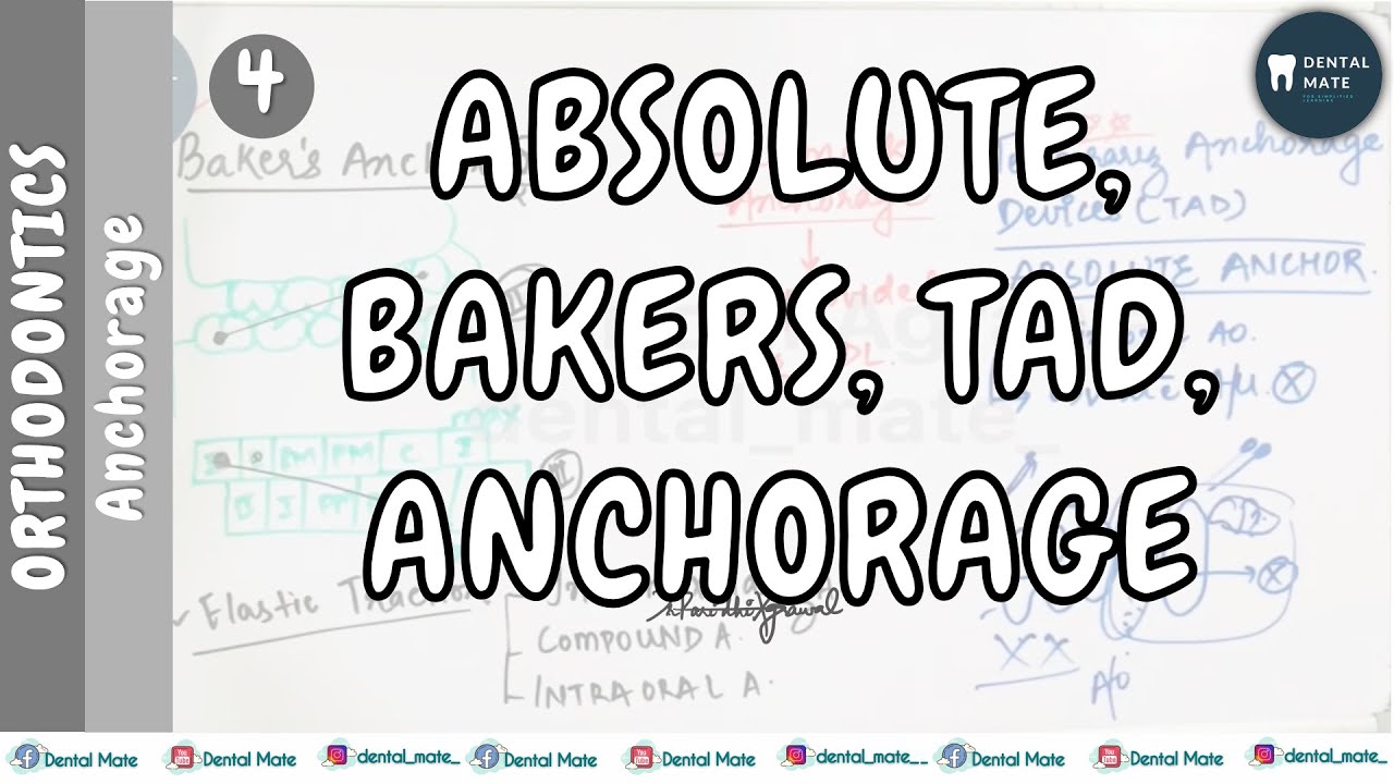 Bakers anchorage | Absolute anchorage | Hammock anchorage | TAD | Part ...
