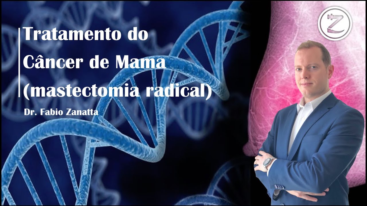 47- Tratamento do Câncer de Mama Agressivo (Mastectomia Radical) - YouTube