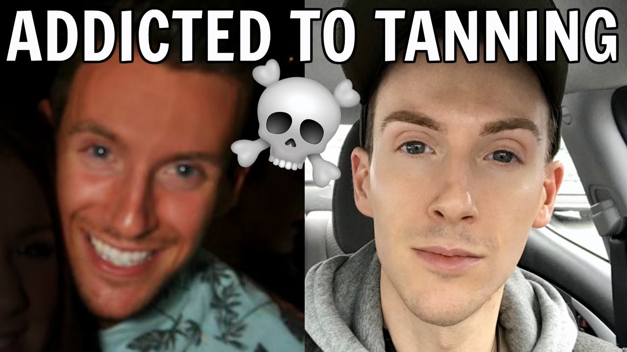 ADDICTED TO TANNING + SKIN CANCER | STORYTIME - YouTube