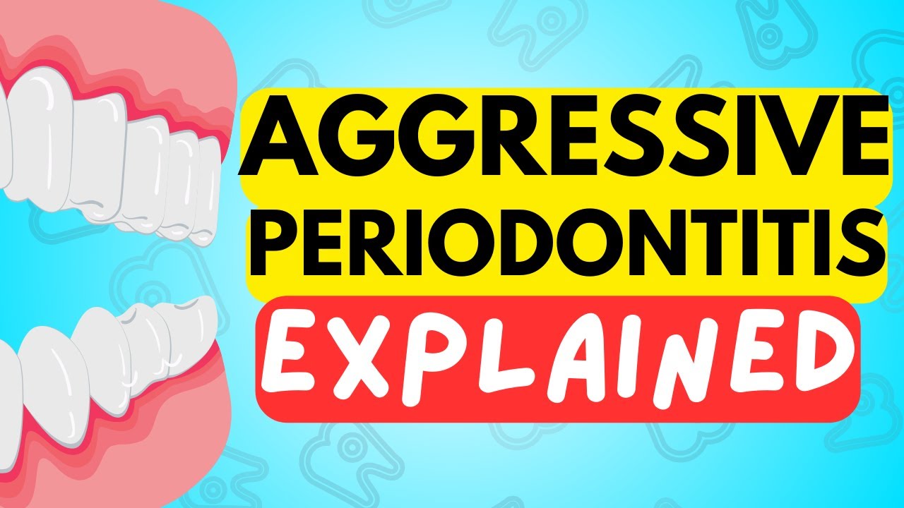 AGGRESSIVE PERIODONTITIS EXPLAINED IN 5 MINUTES - CAUSE, DIAGNOSIS ...