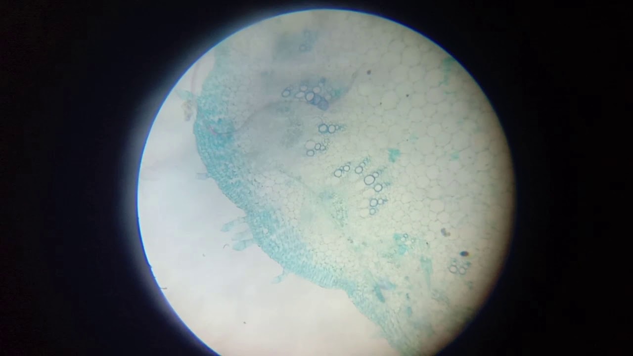 Dicot Root Under Microscope