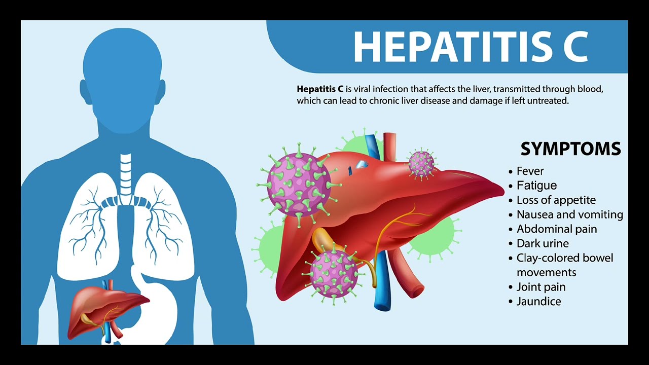 Hepatitis C /Animated Hep C virus/ Sign's & Symptoms - YouTube