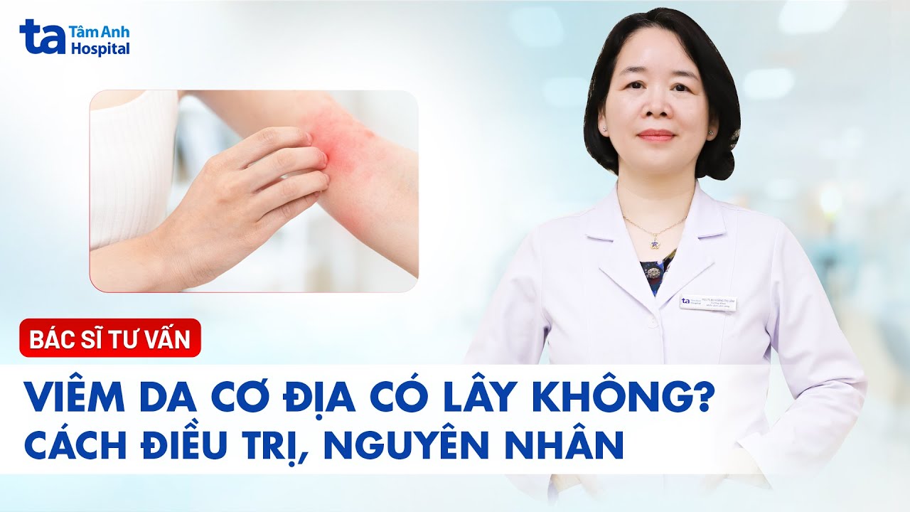 Nguyên nhân gây viêm da cơ địa là gì? Dấu hiệu nhận biết và cách điều ...