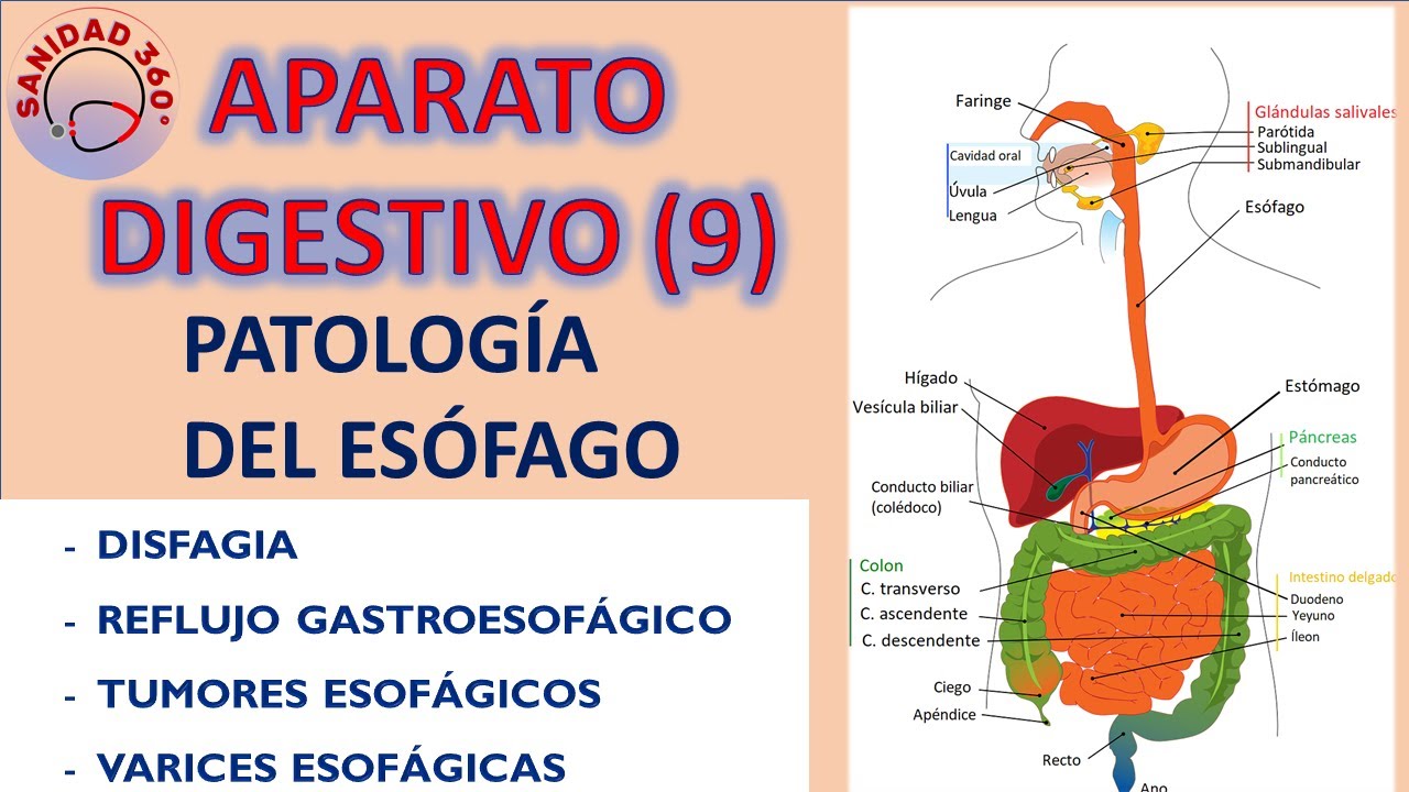 09 APARATO DIGESTIVO | Patología del esófago | - YouTube