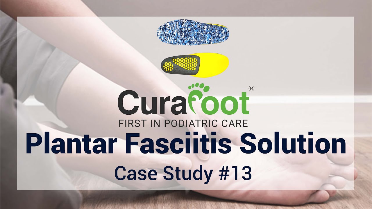CuraFoot Custom 3D Printed Insole Review- Tamojit Dutta | Plantar ...