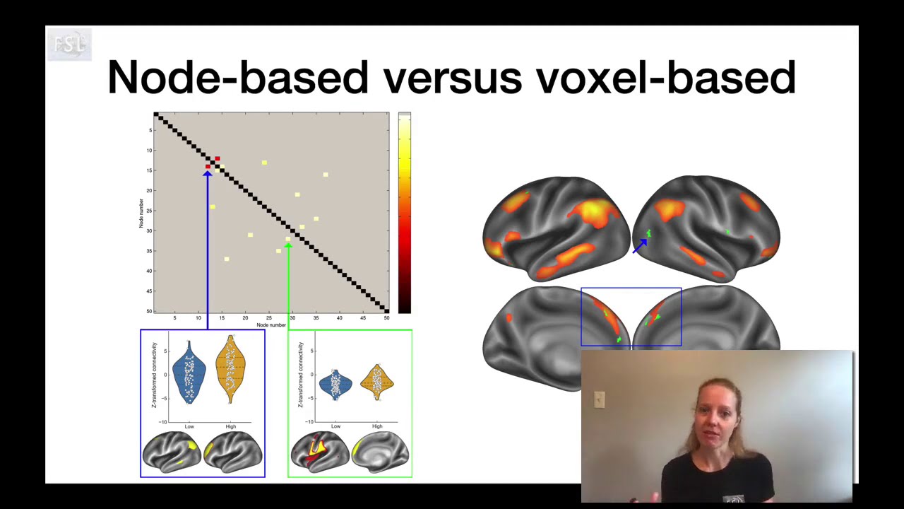35. Resting State: Comparison of Resting State Methods (Nets E4) - YouTube
