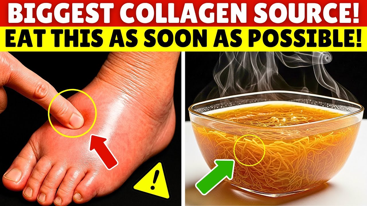 GOODBYE Swelling! 8 Collagen-Rich Foods You MUST Eat for Your LEGS and ...