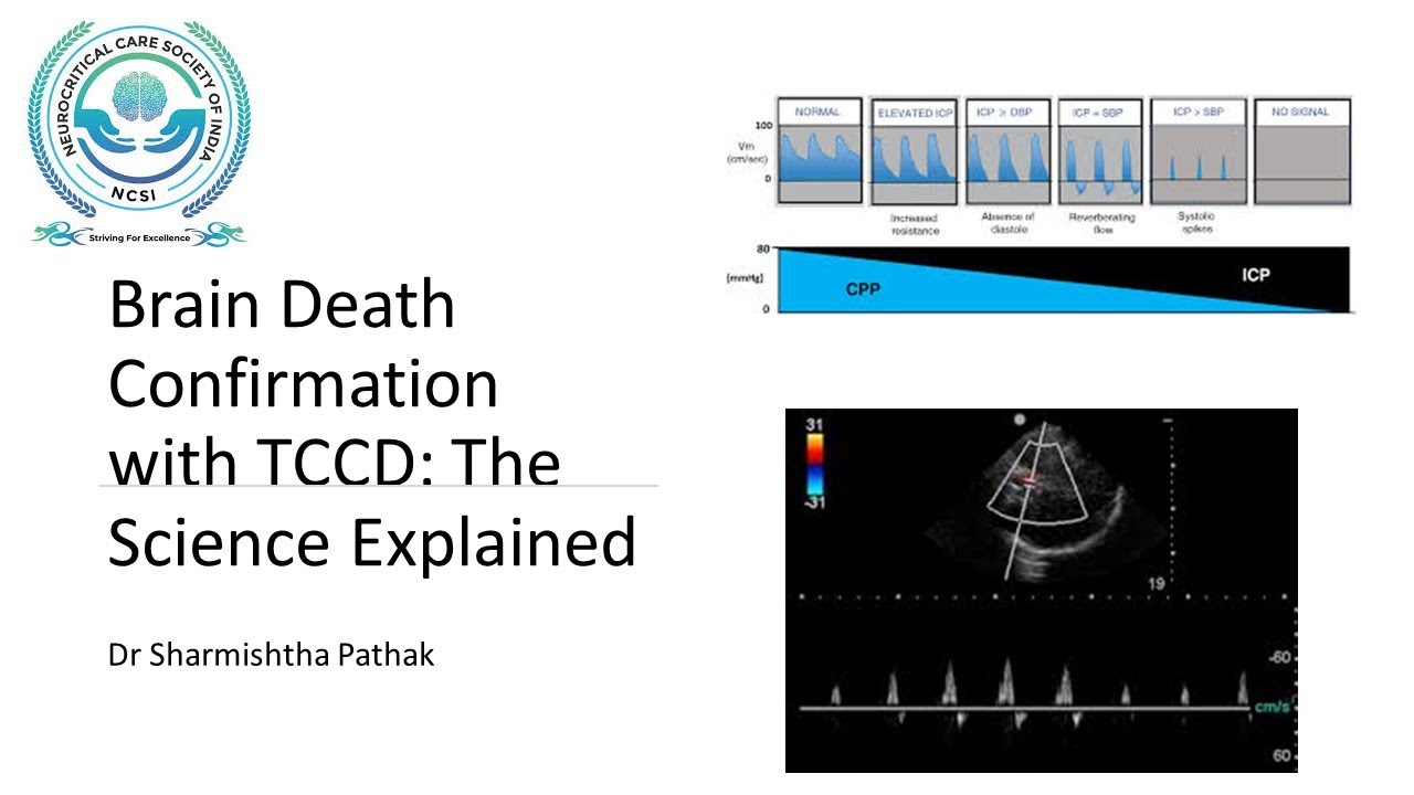 Brain death confirmation with Transcranial Color doppler - YouTube
