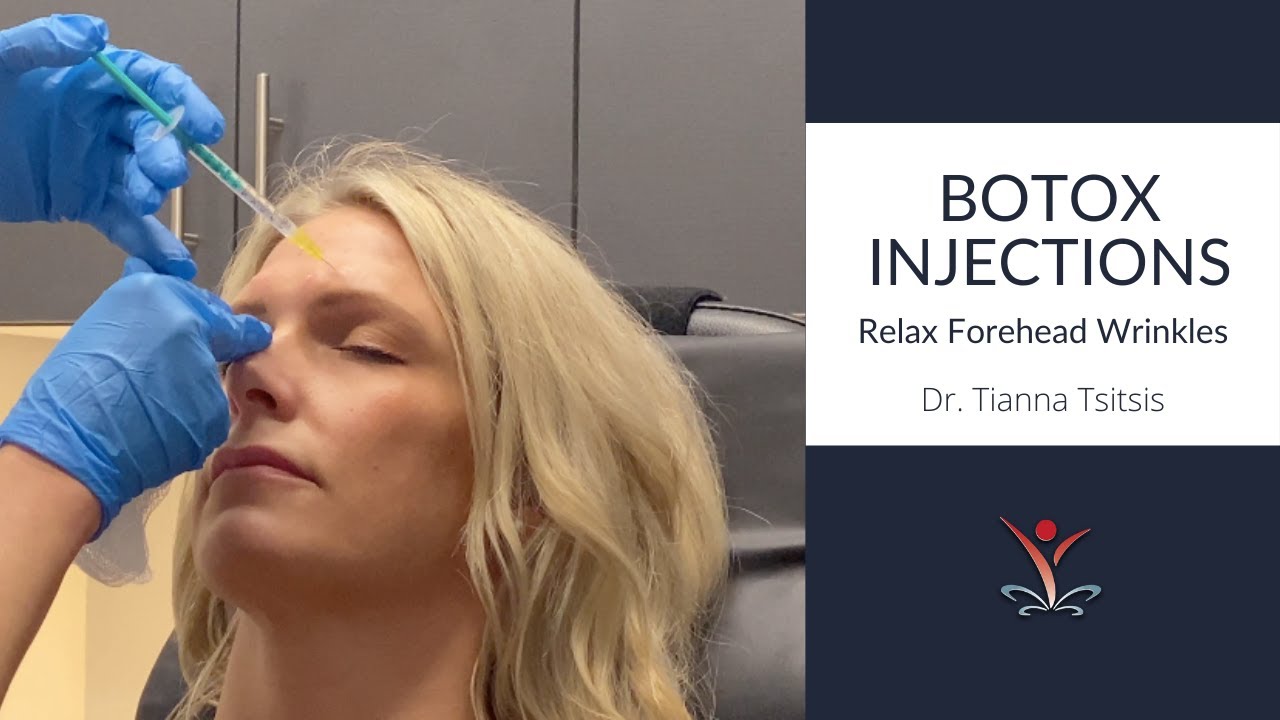 Relax Forehead Wrinkles and the Glabellar with Botox® - YouTube