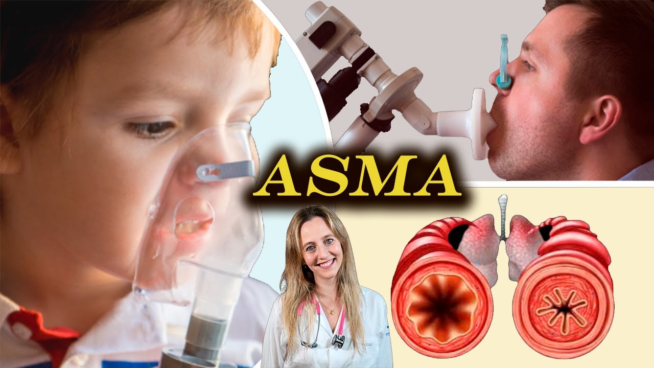 ASMA: SÍNTOMAS, CAUSAS, DIAGNÓSTICO Y TRATAMIENTO - Dra Aperpin - YouTube