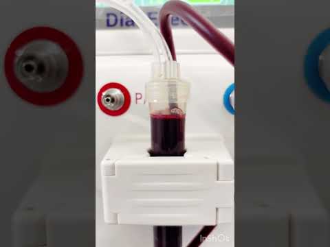 Tara Maa Health Care Dialysis Unit (Polymed Dial Ezee) - YouTube