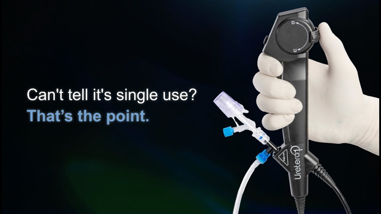 Uretero1™ Single-Use Ureteroscope and Vision1™ Imaging Console | STERIS ...