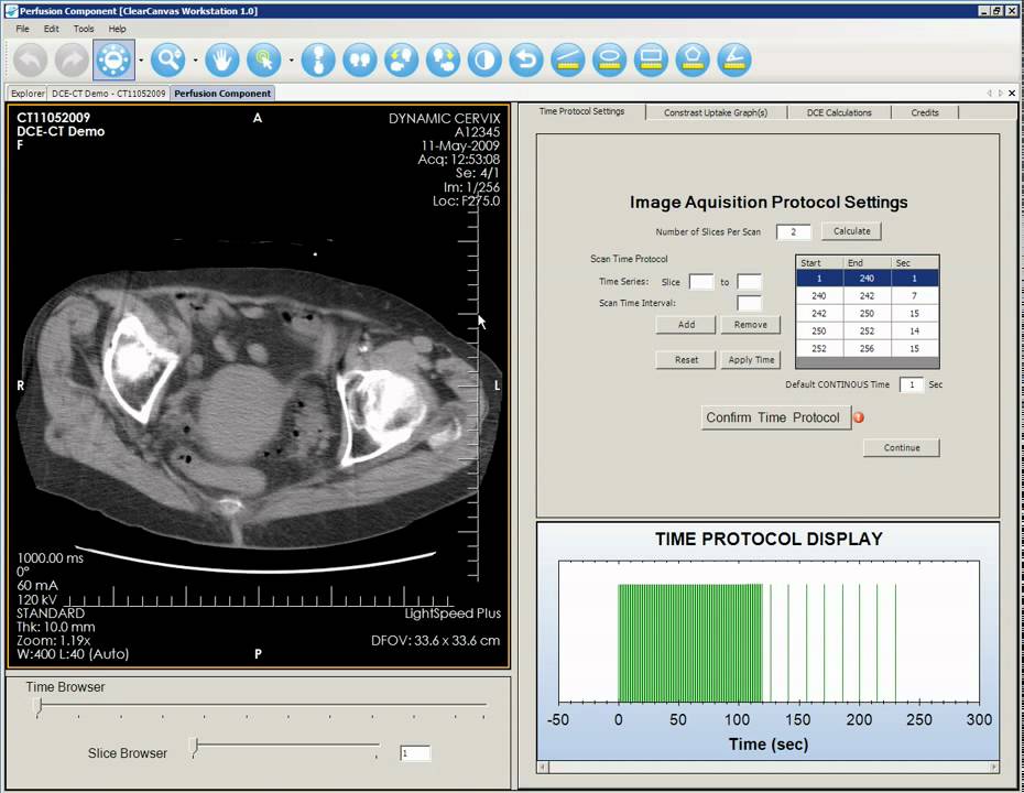 The DCE Tool; DCE CT Analysis Tutorial, Webcast Part 1 - YouTube