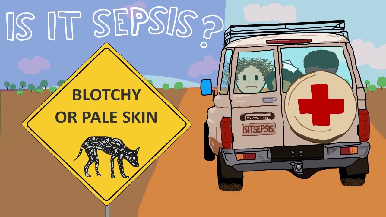 Sepsis Fever Cartoon Sepsis Oxford Medical Education