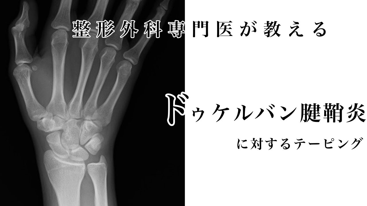 医師が教える！ドゥケルバン腱鞘炎に対するテーピング！【有栖川整形外科】 Youtube 5486