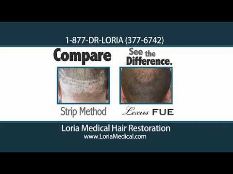WPTV Dr Loria HairTransplant V3 mov - YouTube