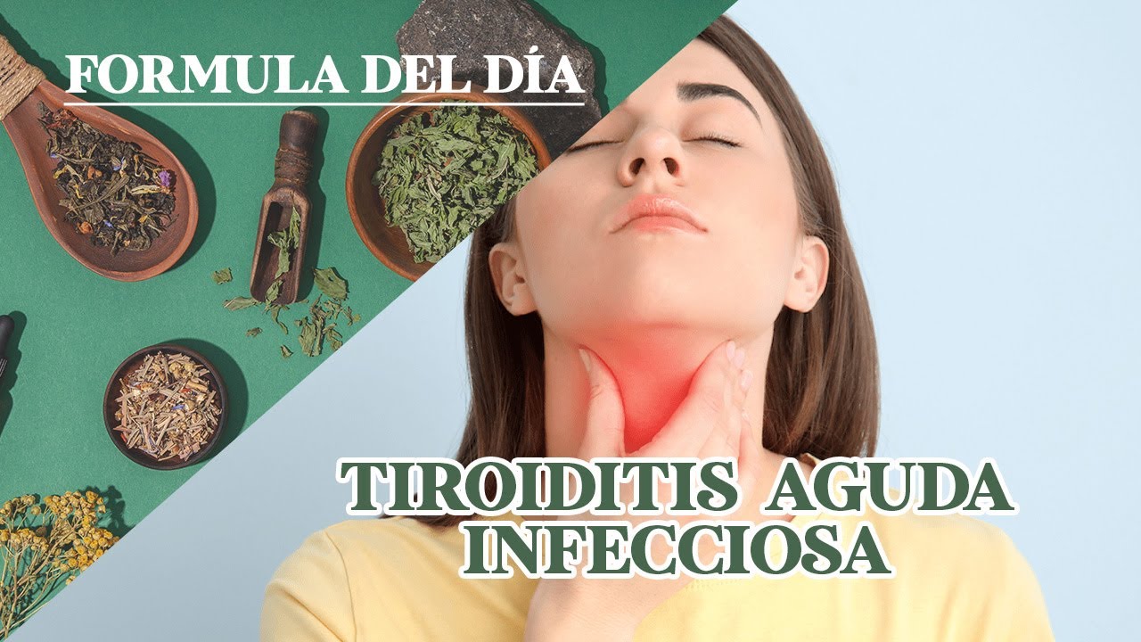 FÓRMULA HERBOLAREA PARA TIROIDITIS AGUDA INFECCIOSA - YouTube
