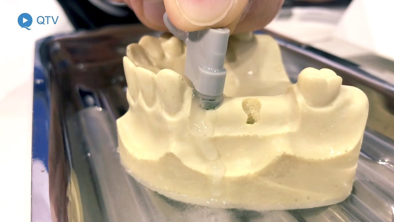 Ionen gegen Biofilm – mit GalvoSurge Implantate reinigen - YouTube