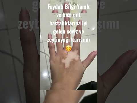 Faydalı Bilgi:Yanık ve bazı cilt hastalıklarına iyi gelen ceviz ve zeytinyağı karışımı😊