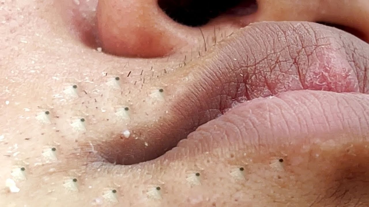 𝐓𝐨𝐩 𝐌𝐨𝐬𝐭 𝐒𝐚𝐭𝐢𝐬𝐟𝐲𝐢𝐧𝐠 𝐏𝐢𝐦𝐩𝐥𝐞 𝐏𝐨𝐩𝐩𝐢𝐧𝐠 𝐌𝐨𝐦𝐞𝐧𝐭𝐬 – 𝐃𝐚𝐫𝐞 𝐭𝐨 𝐖𝐚𝐭𝐜𝐡 #𝟏𝟎𝟓𝟏 - YouTube