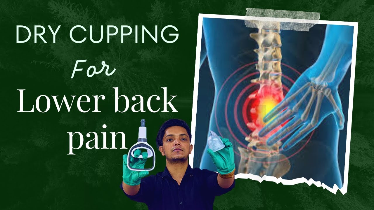 DRY CUPPING FOR LOWER BACK PAIN??? || BEST TREATMENT EVER|| HAPPY ...