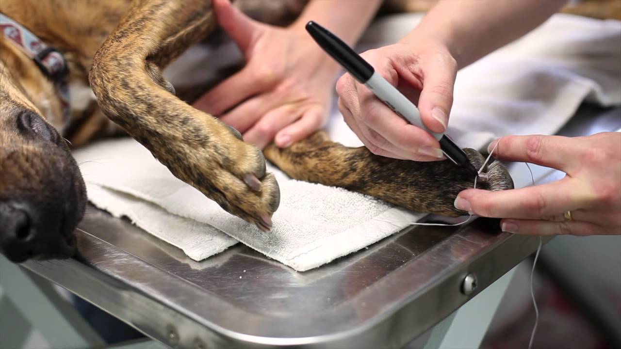 ToeGrips Video Series - Measuring for ToeGrips - YouTube