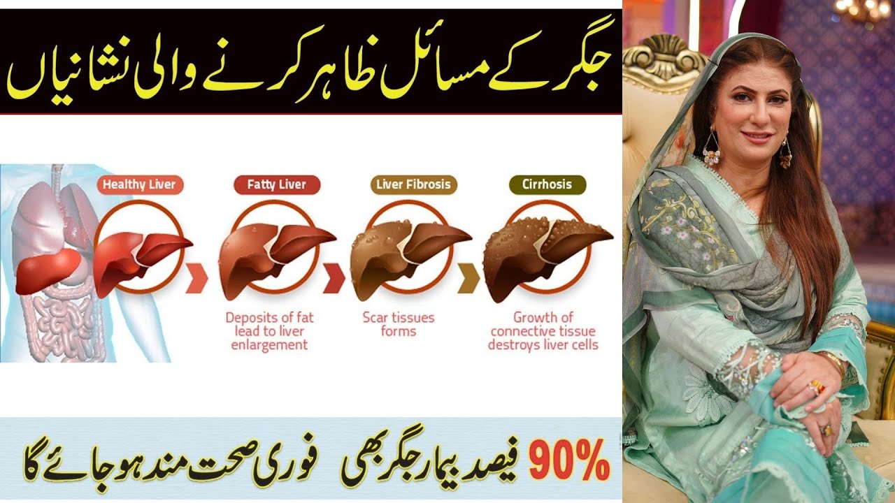 Top Healthy for Fatty Liver | Liver Treatment | Liver Disease | By Dr ...